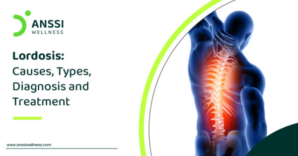 Lordosis: Causes, Types, Diagnosis and Treatment