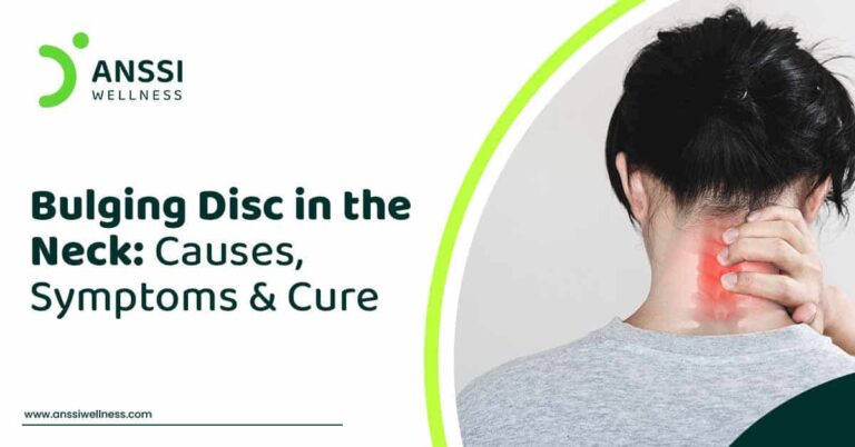 Bulging Disc in the Neck: Causes, Symptoms & Cure