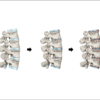 Ankylosing Spondylitis vs. Other Types of Arthritis: Key Differences