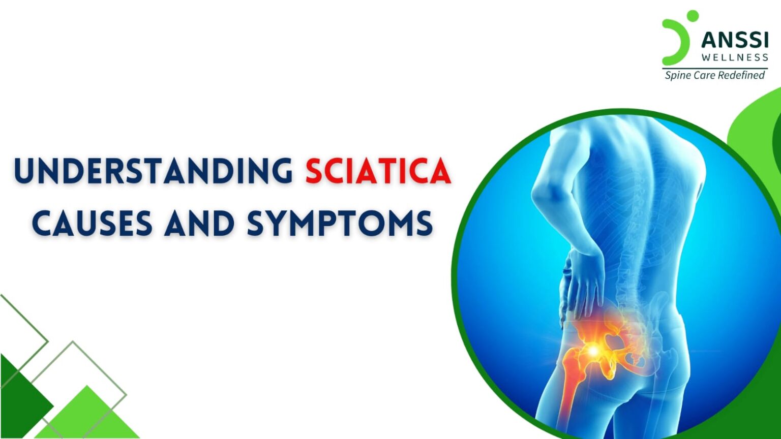Sciatica Causes, Symptoms, & Non-Surgical Treatments