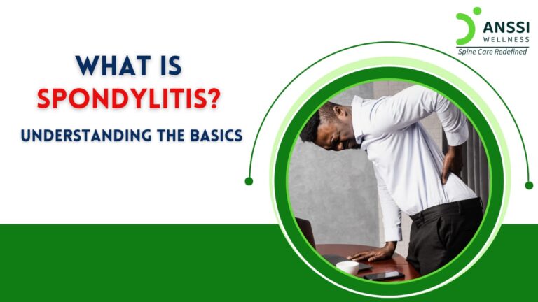 Spondylitis Causes, Symptoms, Types, and Treatment Options
