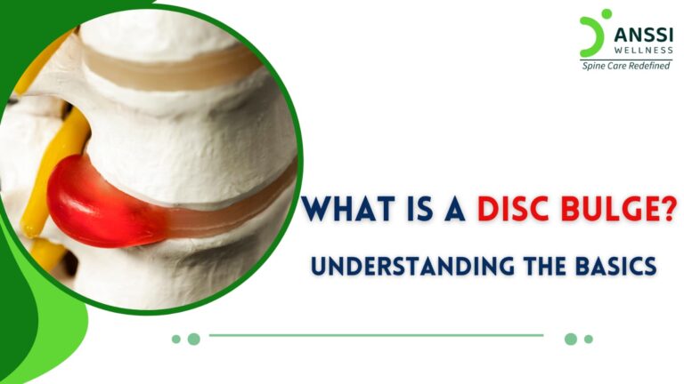What is a Disc Bulge? - Understanding the Basics - ANSSI Wellness