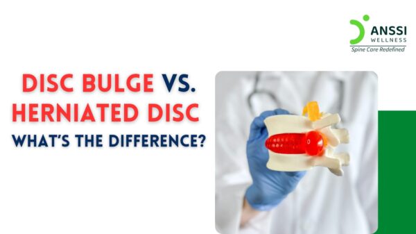 Disc Bulge vs. Herniated Disc: What’s the Difference? - ANSSI Wellness
