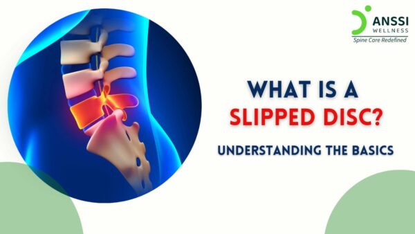 Slipped Disc: Symptoms, Causes & Non-Surgical Treatment Options
