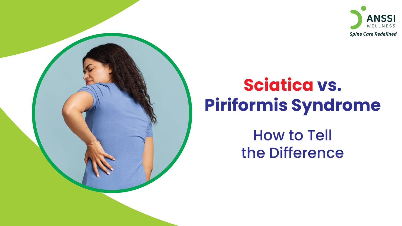 Sciatica vs Piriformis: Differences & Treatments