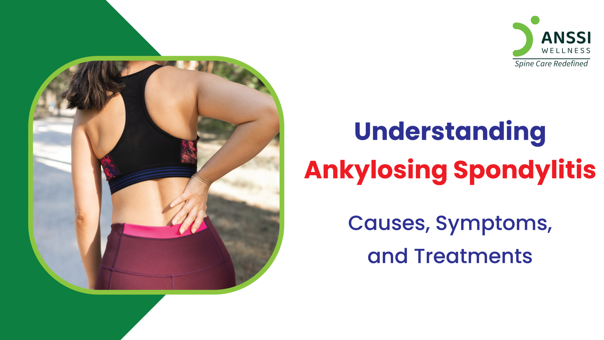 Ankylosing Spondylitis Treatment – Pain Relief Without Surgery