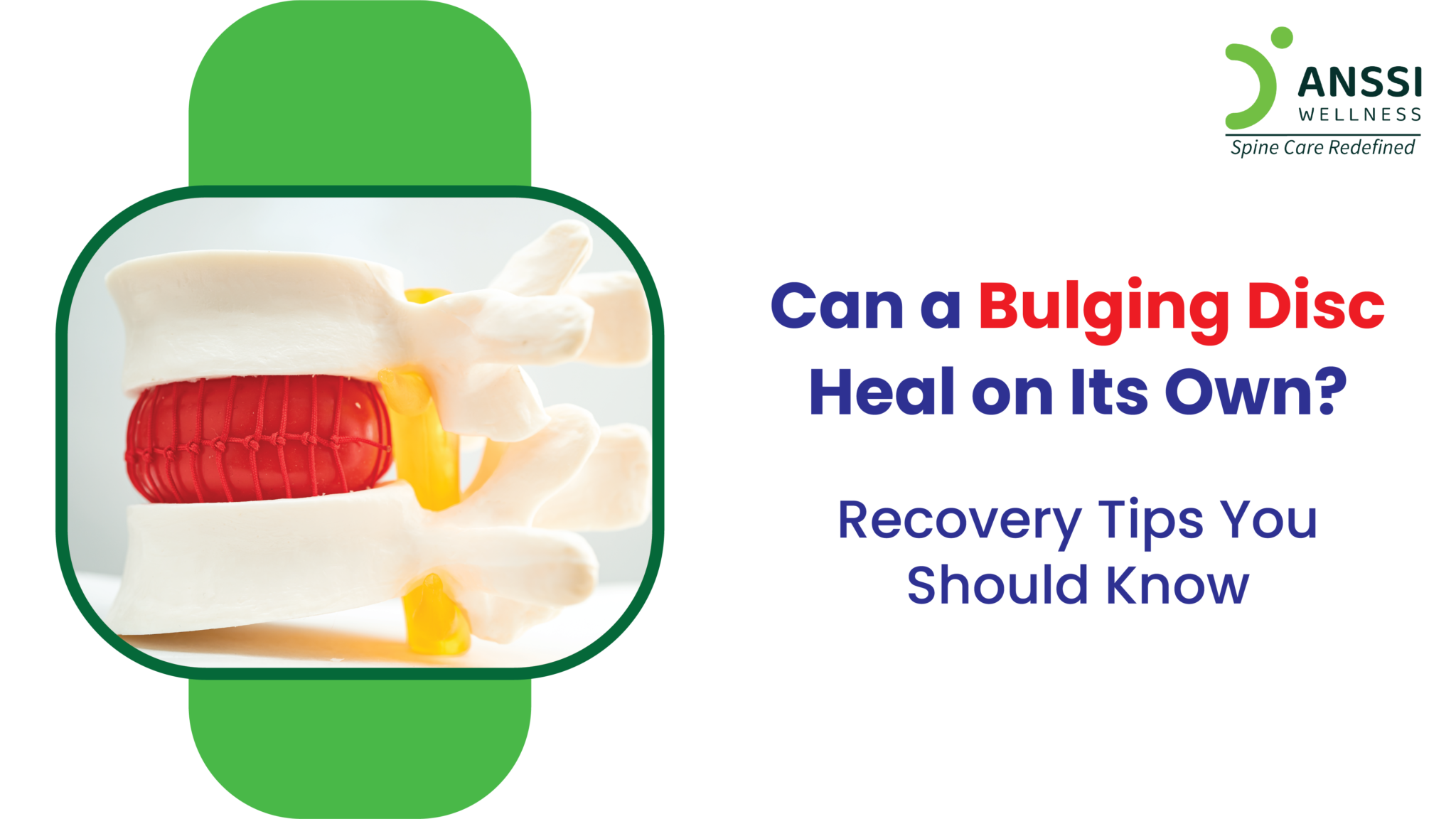 Can a Bulging Disc Heal Naturally? | Non-Surgical Spine Care