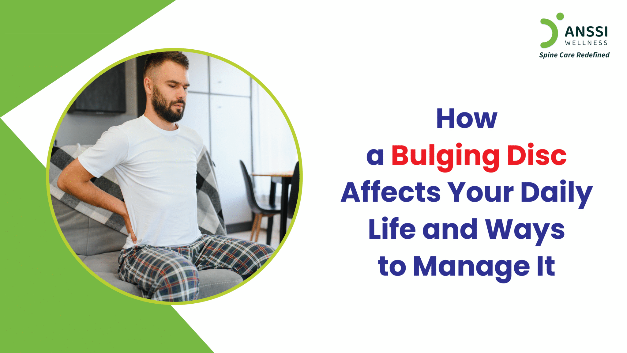 Bulging Disc: Natural Relief Without Surgery