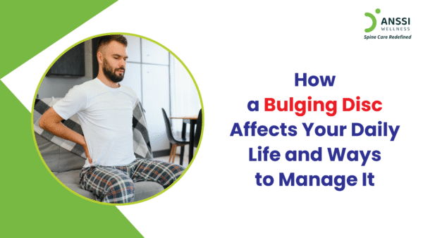 Bulging Disc: Natural Relief Without Surgery