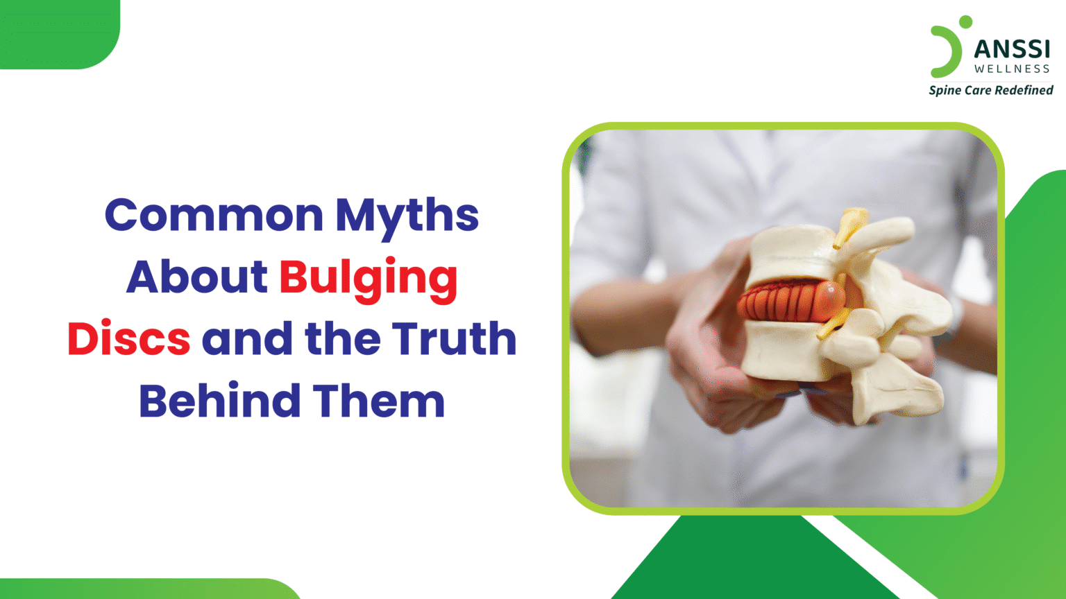 Bulging Disc Treatment: Myths, Facts & Non-Surgical Care