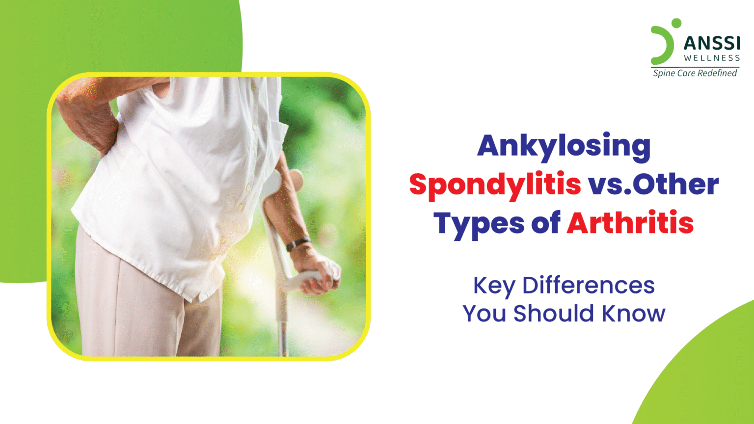 Ankylosing Spondylitis vs. Other Types of Arthritis: Key Differences