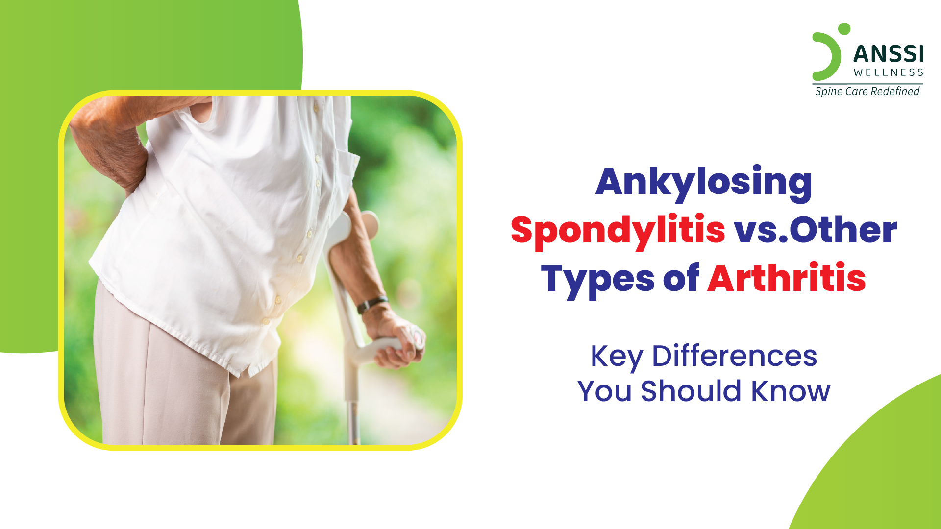 Ankylosing Spondylitis vs. Other Types of Arthritis: Key Differences