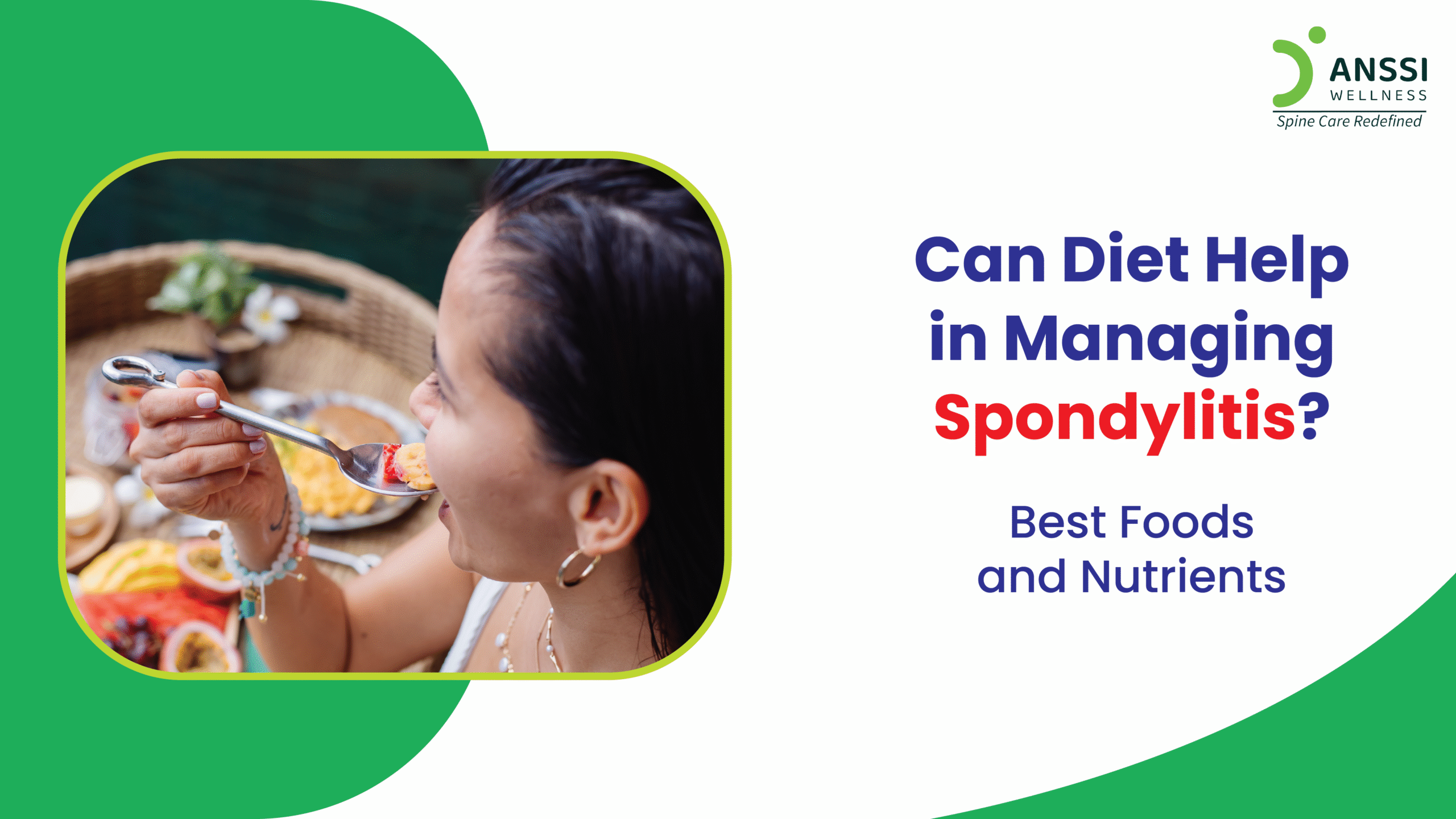 Best Diet Tips for Managing Spondylitis Naturally