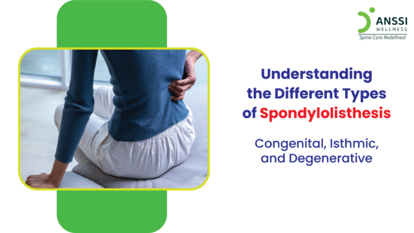Types of Spondylolisthesis and How to Manage Them