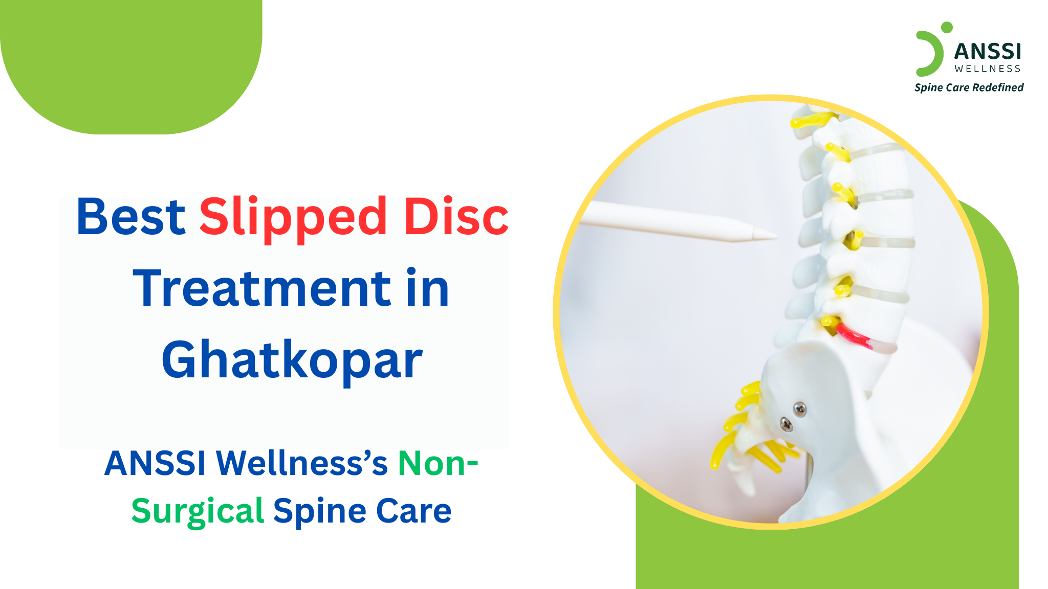 Slipped Disc Treatment in Ghatkopar