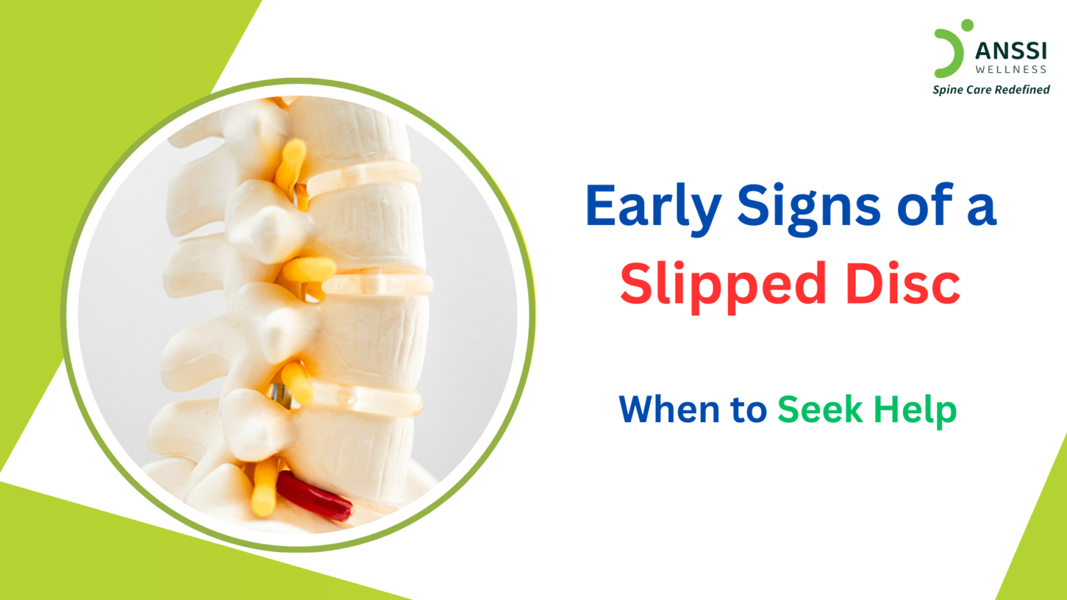 Early Signs of a Slipped Disc and When to Seek Treatment