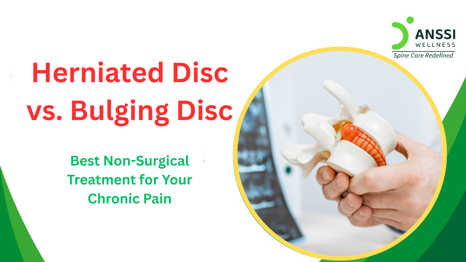 Bulging Disc vs Herniated Disc: Key Differences & Treatment Options
