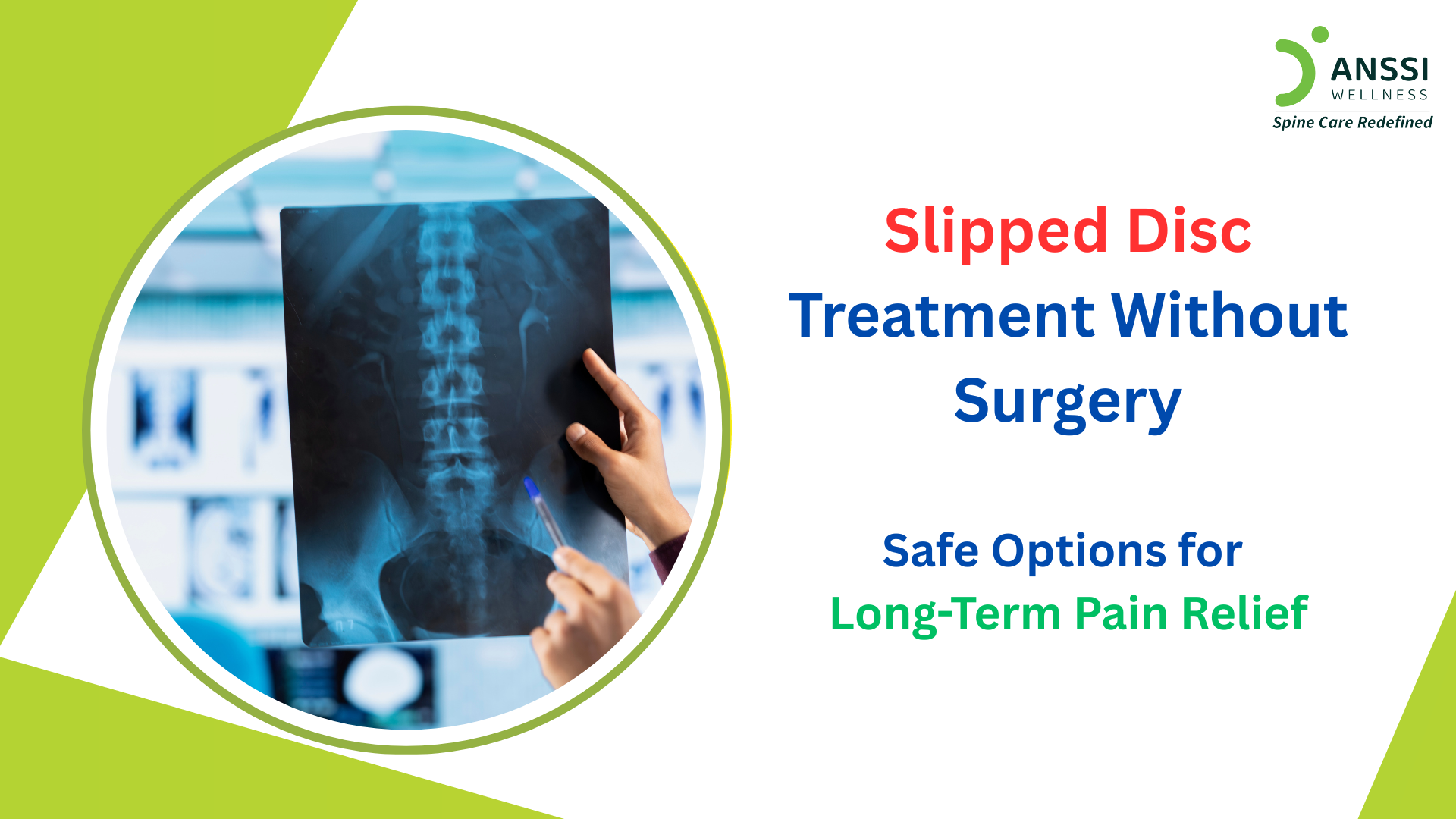 Slipped Disc Treatment Without Surgery | ANSSI Wellness